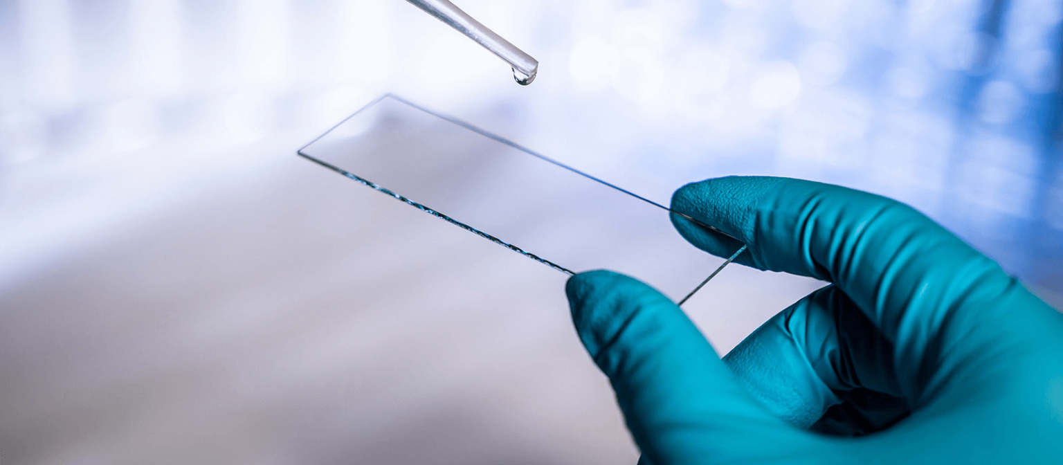 Lead Service Line Inventory - Cal Water